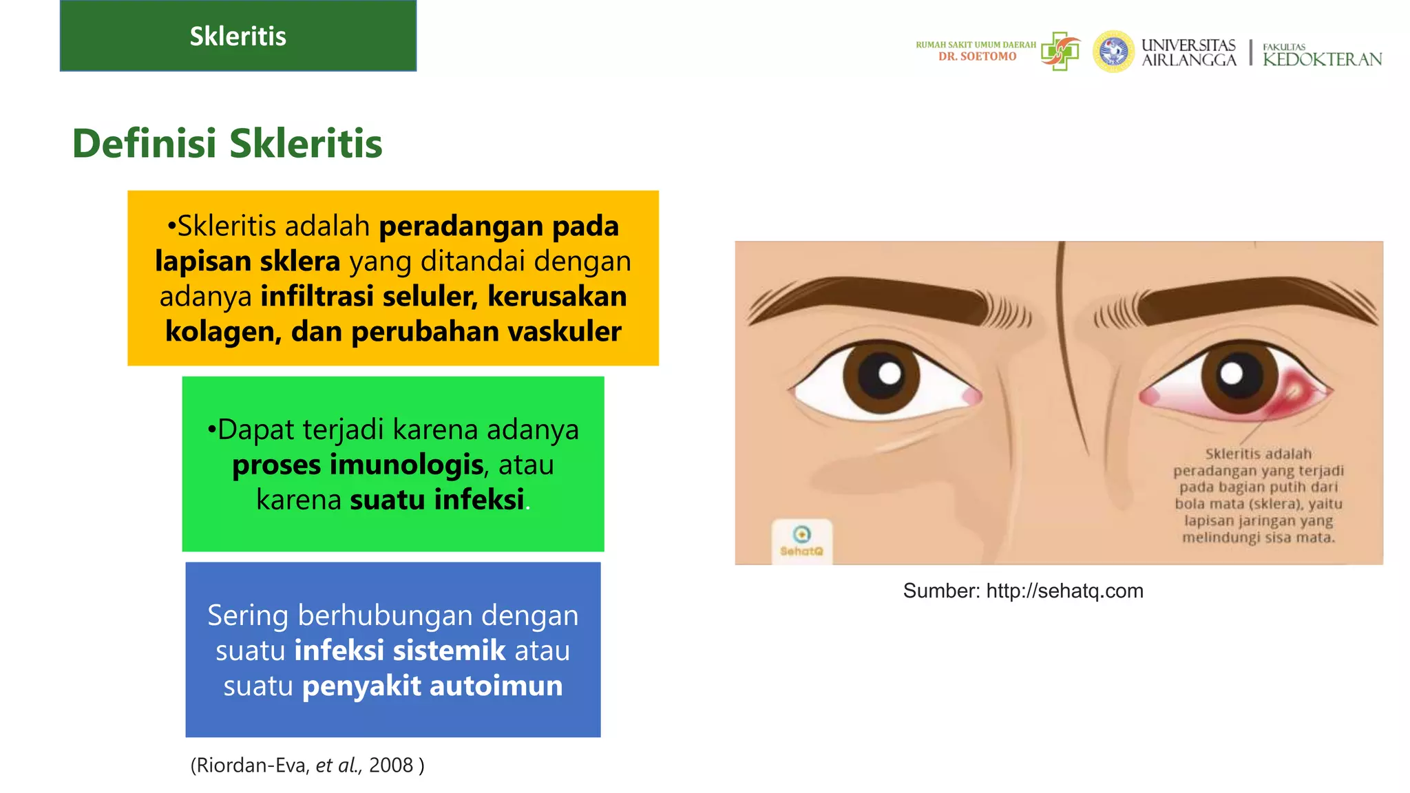 8. PPT Skleritis Episkleritis_Adinda Sandya P._011923143086.pptx
