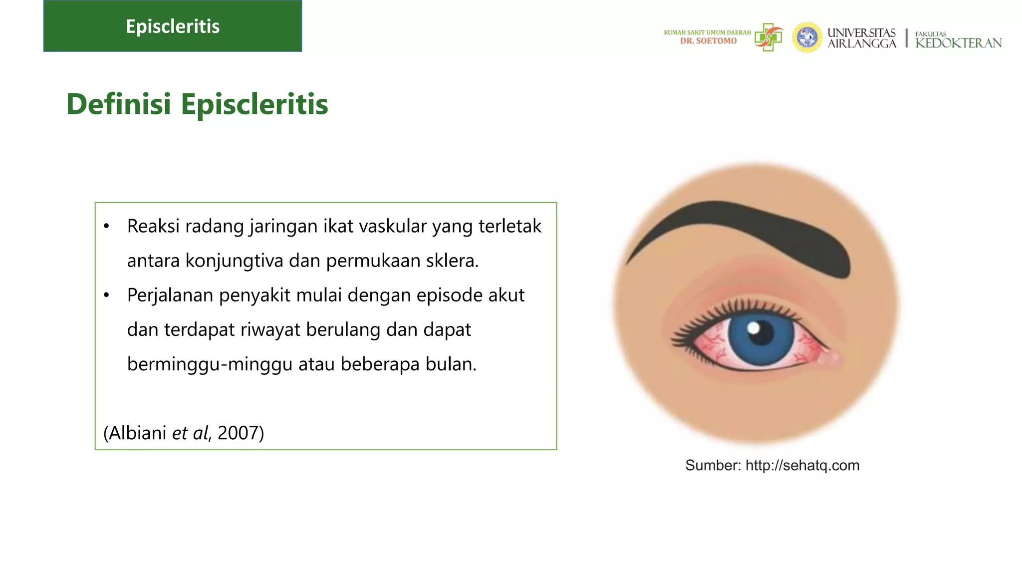8. PPT Skleritis Episkleritis_Adinda Sandya P._011923143086.pptx