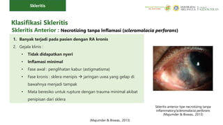 8. PPT Skleritis Episkleritis_Adinda Sandya P._011923143086.pptx