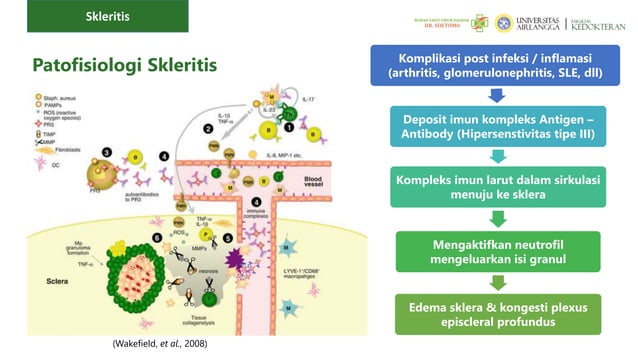 8. PPT Skleritis Episkleritis_Adinda Sandya P._011923143086.pptx
