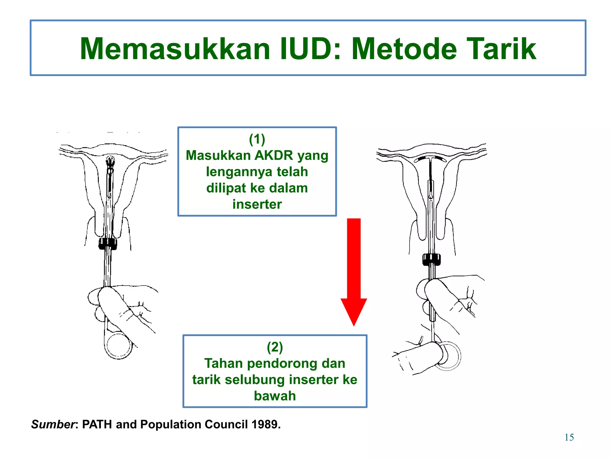 AKDR.ppt