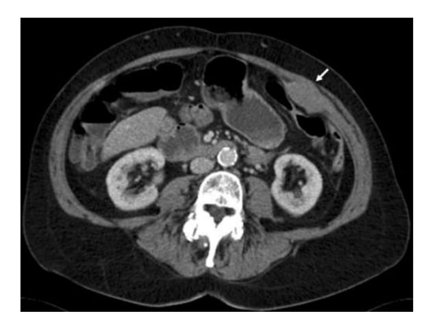 8.Posterior abdominal wall and Retroperitoneal Organs.pptx