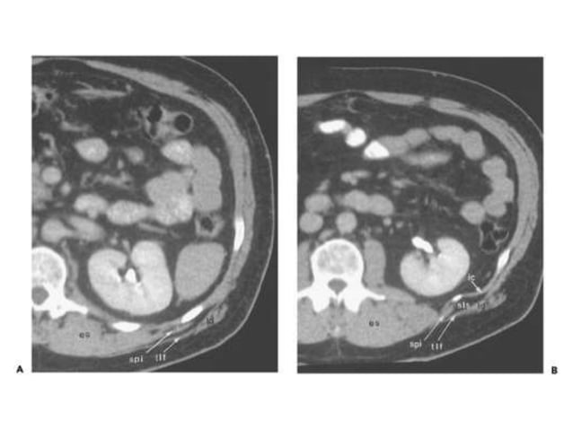 8.Posterior abdominal wall and Retroperitoneal Organs.pptx