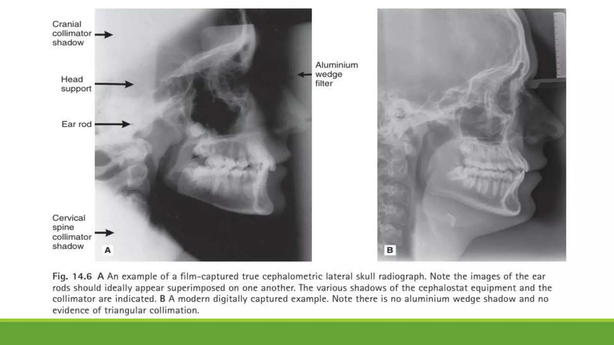 8. Cephalometric Radiography.pptx