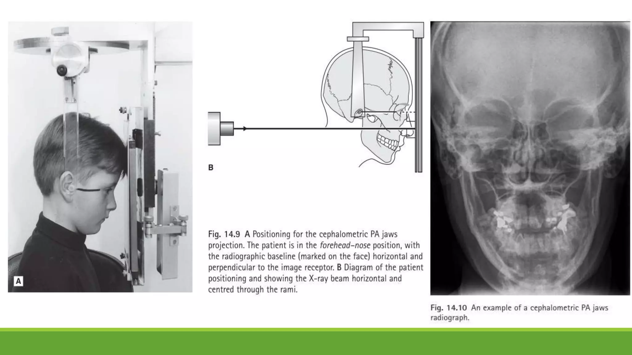 8. Cephalometric Radiography.pptx