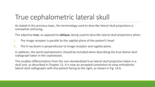 8. Cephalometric Radiography.pptx