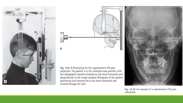 8. Cephalometric Radiography.pptx | Dental Health | Diseases and Conditions