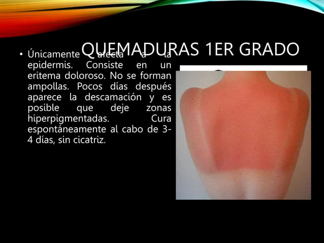 8.1-Cuidados-de-enfermeria-en-el-paciente-con-quemaduras (1).pptx