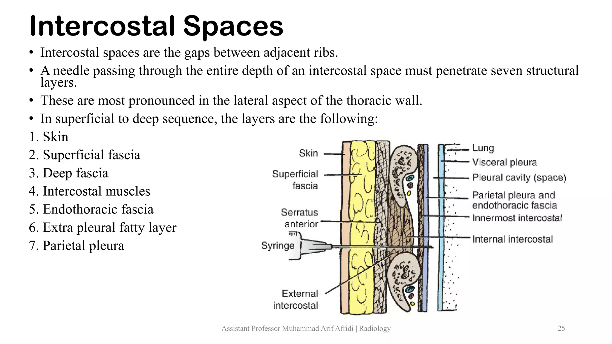 Anatomy of Thoracic Wall.pdf