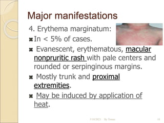 8. Acute Rheumatic fever (1).ppt