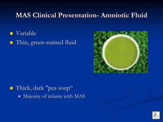 8.c Meconium Aspiration.ppt