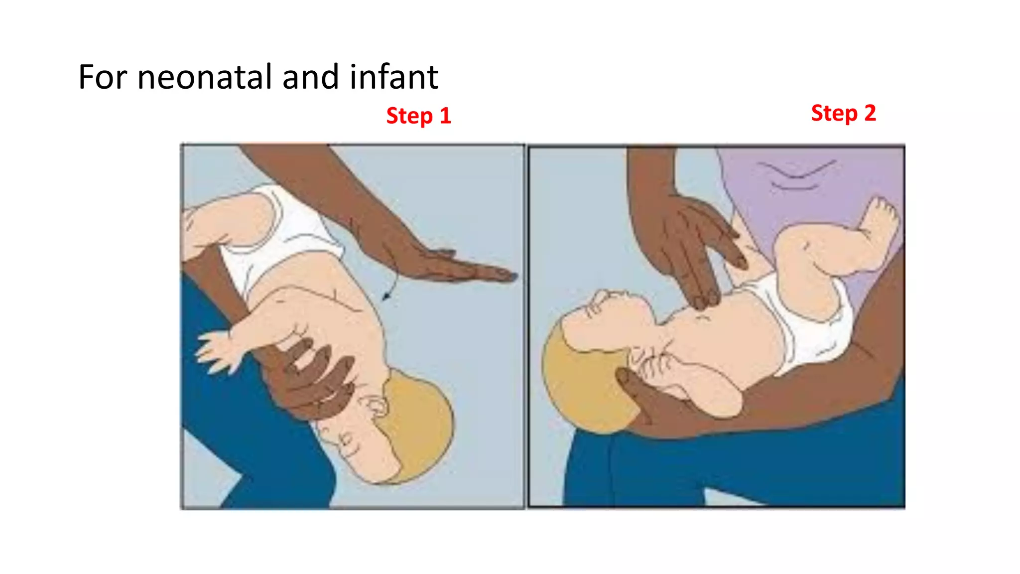 First aid Foreign object obstruction.pdf