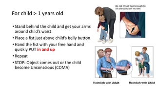 First aid Foreign object obstruction.pdf