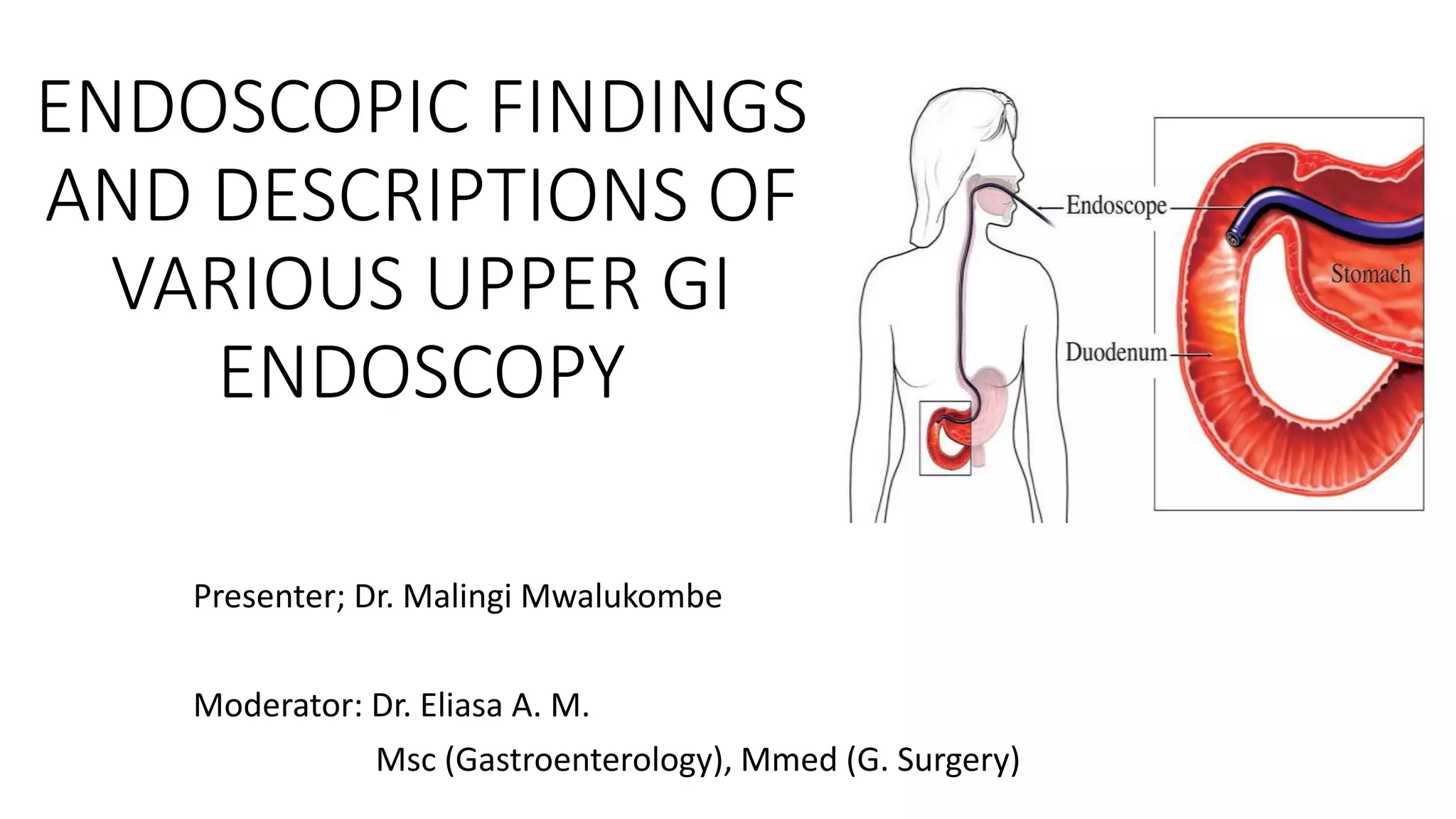 8. Upper GI findings.pptx