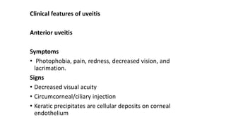 8. UVEAL TRACT DISORDERS.pptx