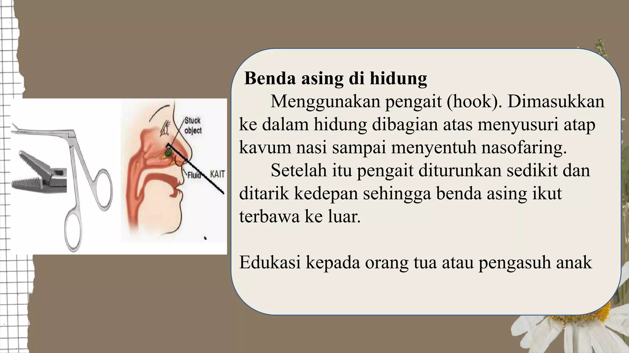 8. Benda Asing.pptx