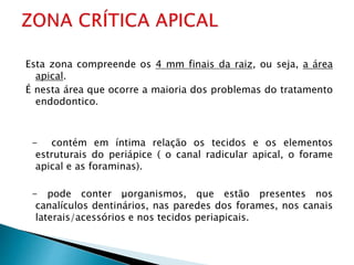 8.Preparação biomecânica dos canais radiculares.ppt