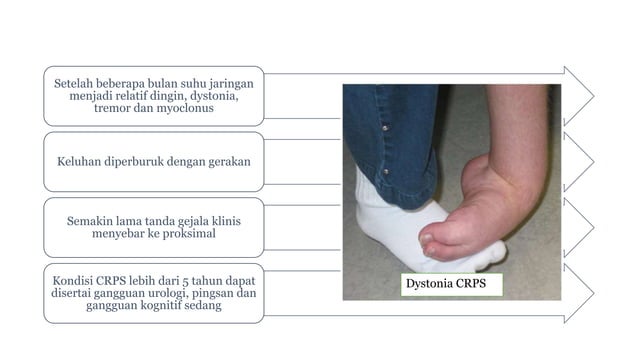8. Complex regional Pain Syndrome.pptx