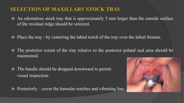 8. IMP TECHNIQUES.pptx