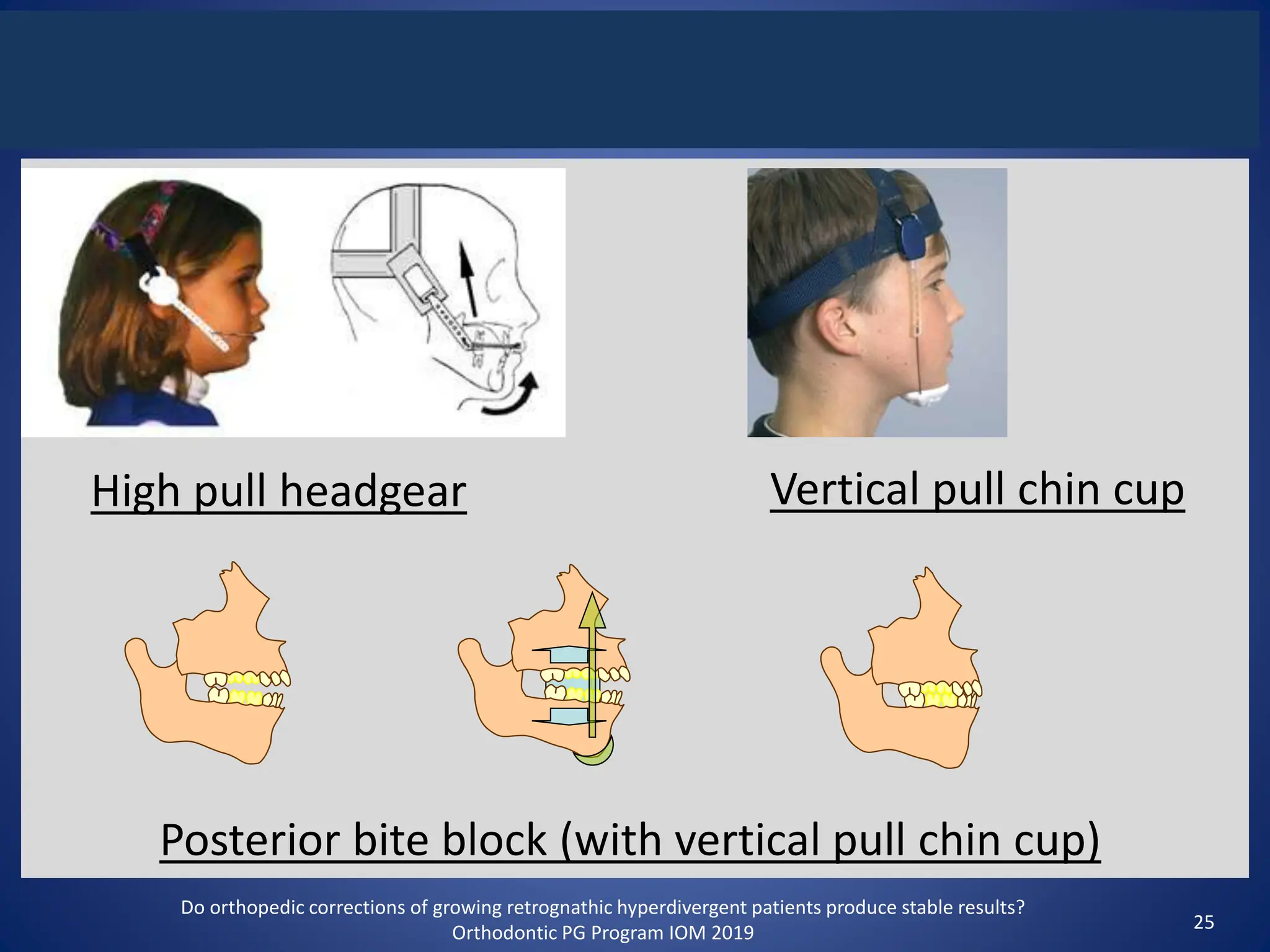 8. Prediction of mandibular movement and its center of rotation 2075-2 ...