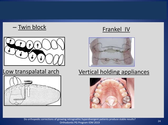 8. Prediction of mandibular movement and its center of rotation 2075-2 ...