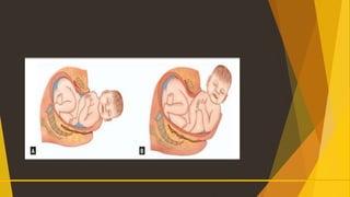 8. . Labour - 2nd Stage - Management.pptx