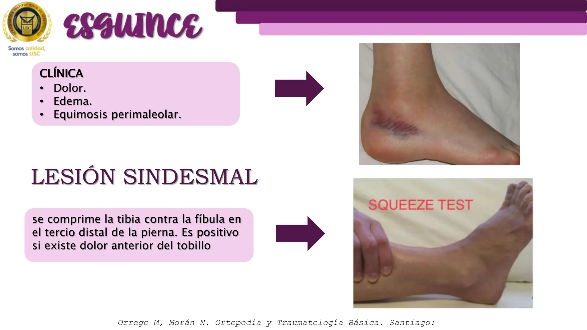 Anatomia de Rodilla - univeridad santiago de cali | PPTX