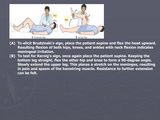 8. MENINGITIS-ENCEPHALITIS medical surgical nursing.ppt