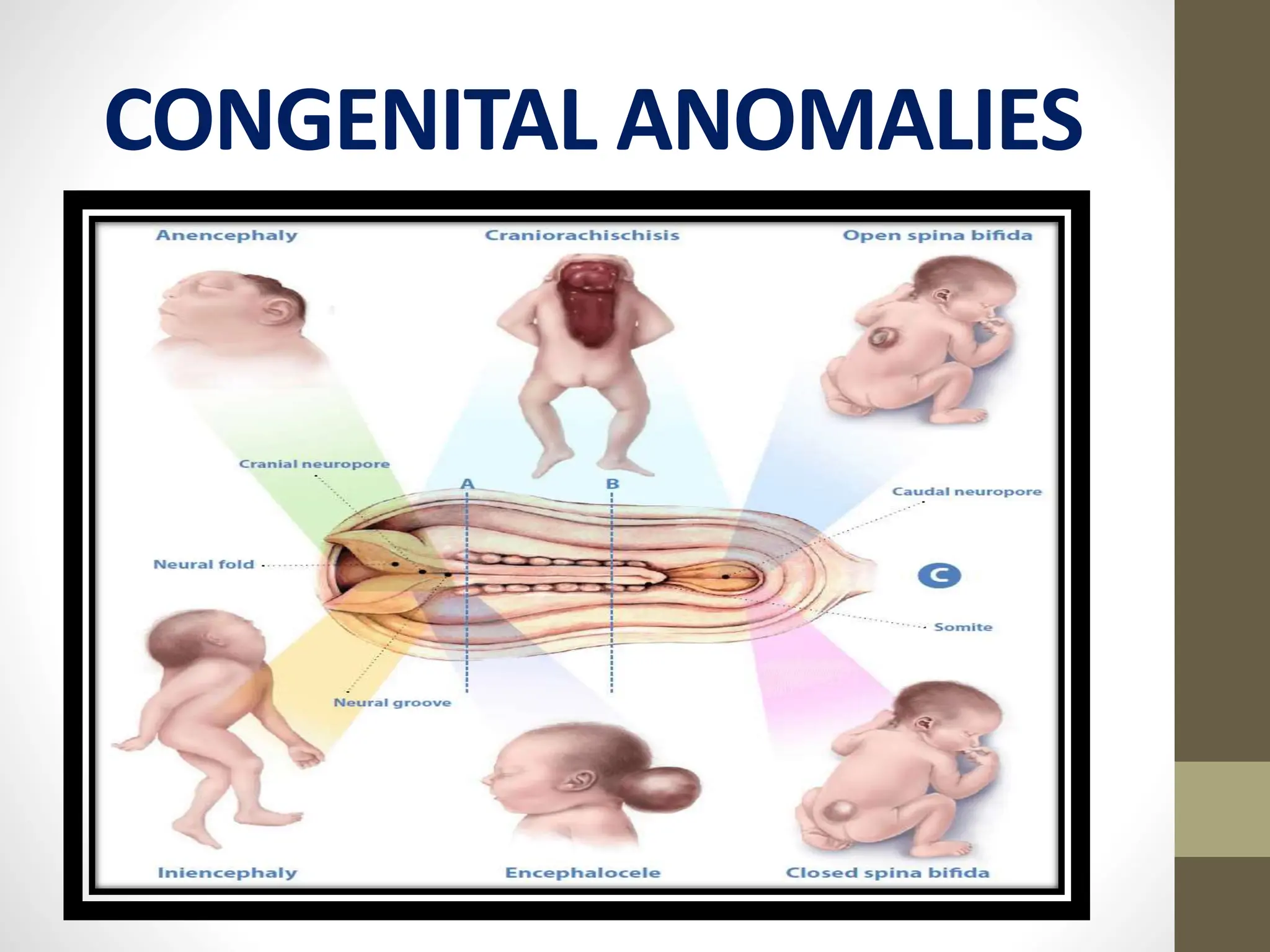 8.CONGENITAL ANOMALIES PPT orthopedic nursing | PPTX