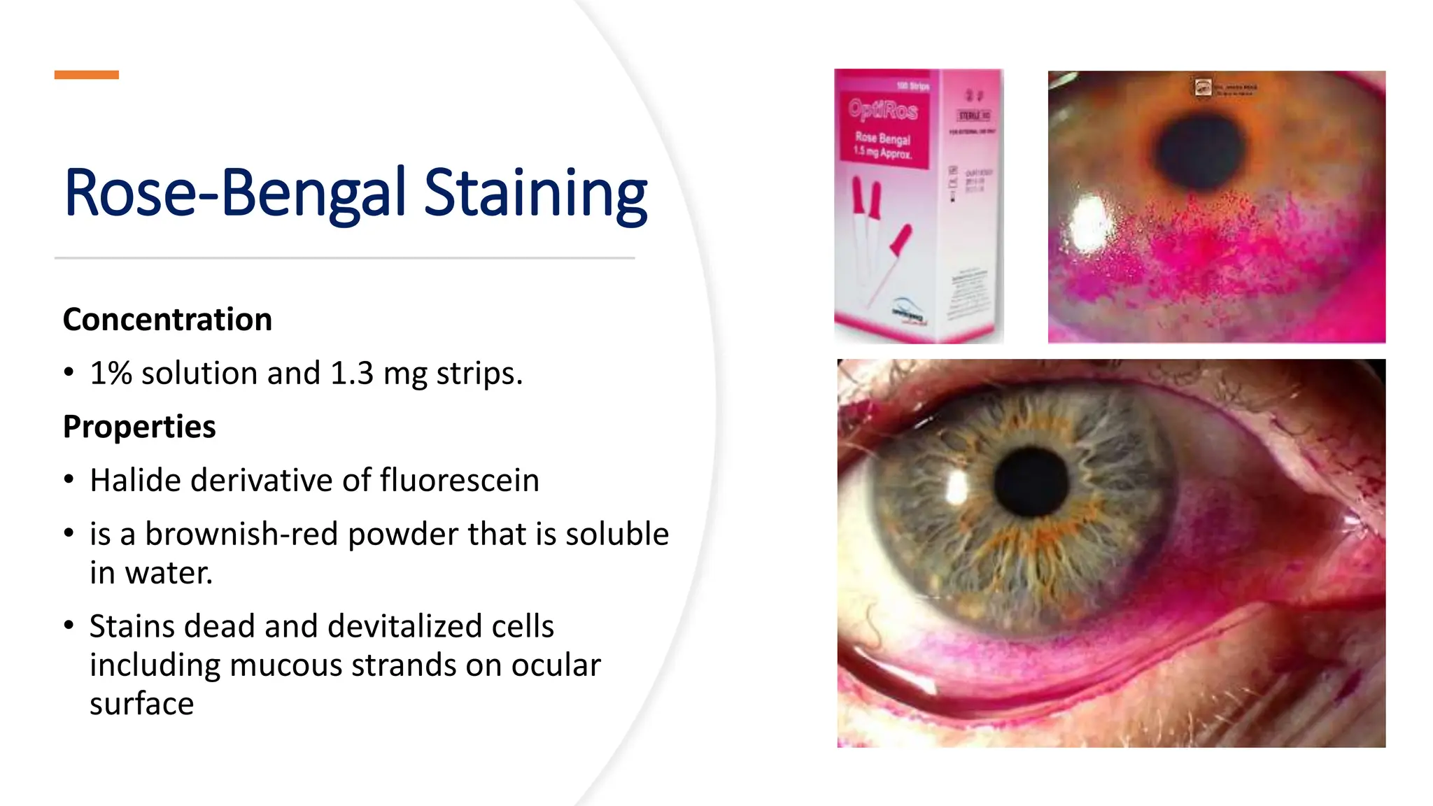 Vital dyes and stains Used in Ophthalmic Practice.pptx