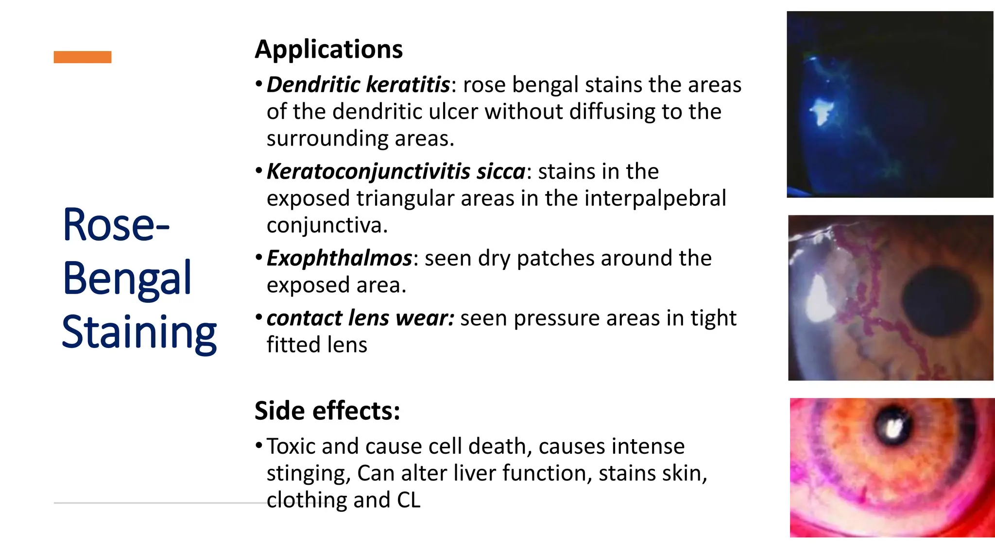 Vital dyes and stains Used in Ophthalmic Practice.pptx