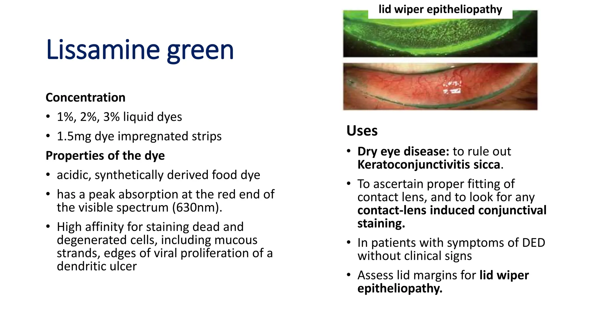 Vital dyes and stains Used in Ophthalmic Practice.pptx