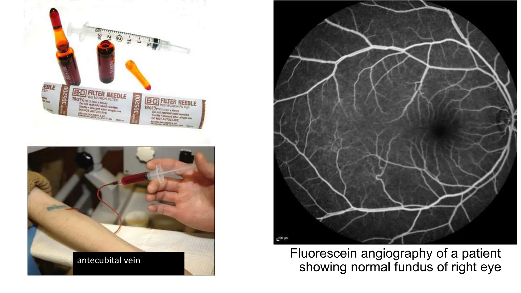Vital dyes and stains Used in Ophthalmic Practice.pptx