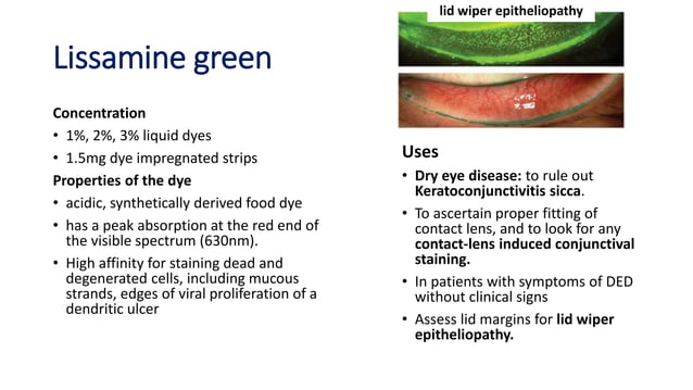 Vital dyes and stains Used in Ophthalmic Practice.pptx