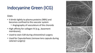 Vital dyes and stains Used in Ophthalmic Practice.pptx