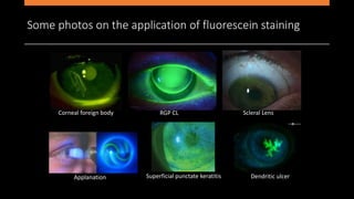 Vital dyes and stains Used in Ophthalmic Practice.pptx