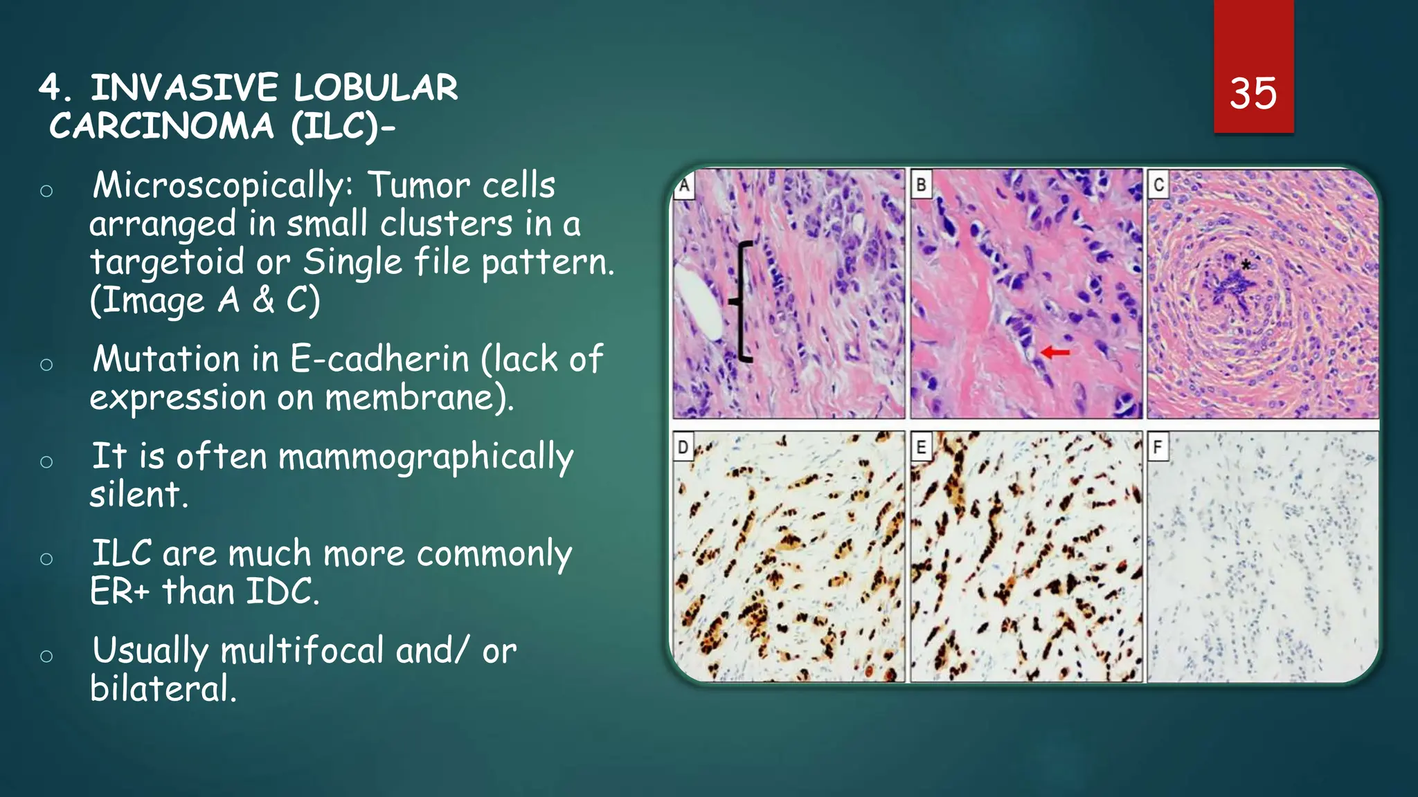 8. Breast Cancer Diagnostic Workup .pptx