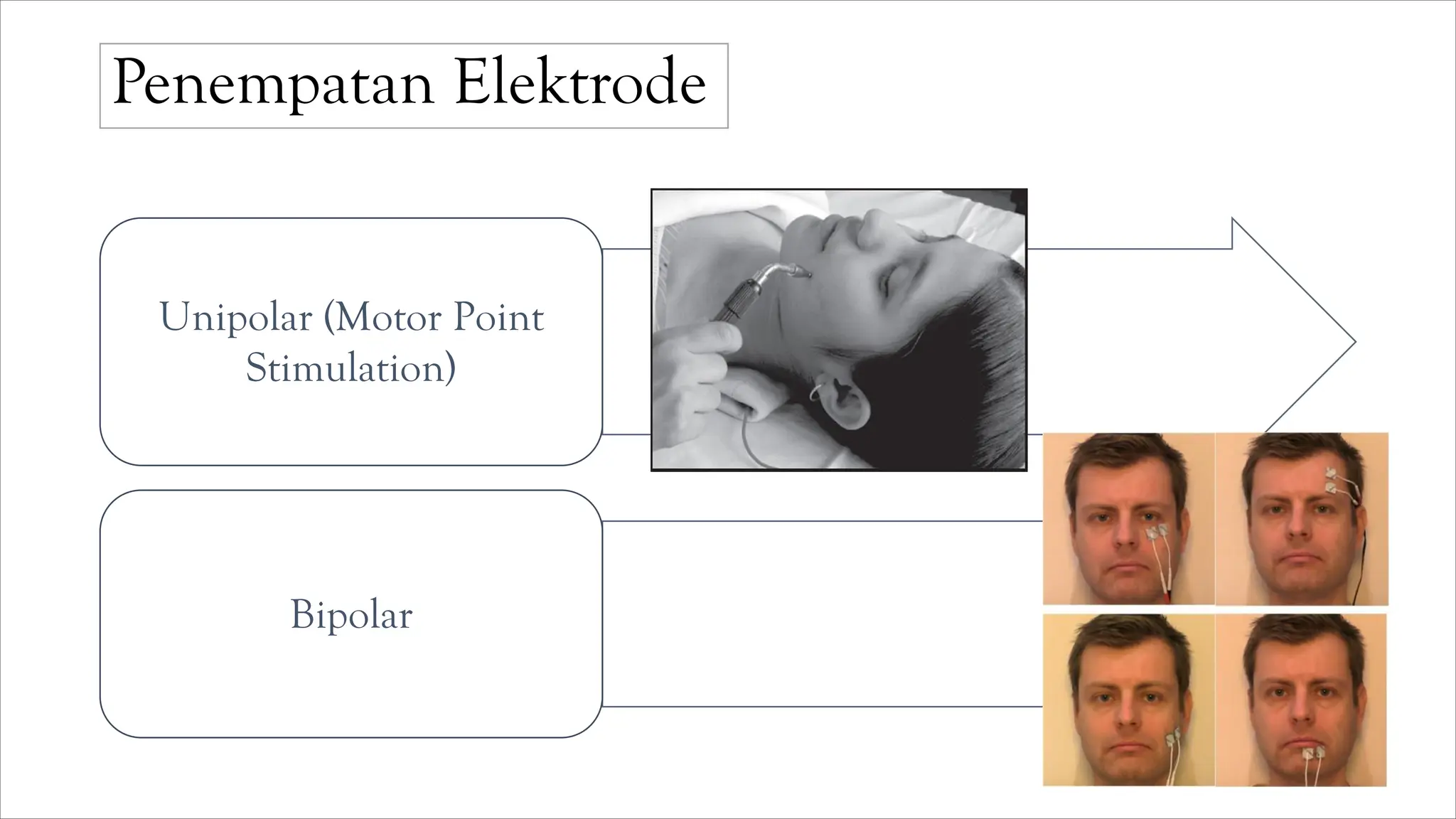 Materi Elektroterapi Fisioterapi Interrupted Galvanic (Exponential) Current | PPT