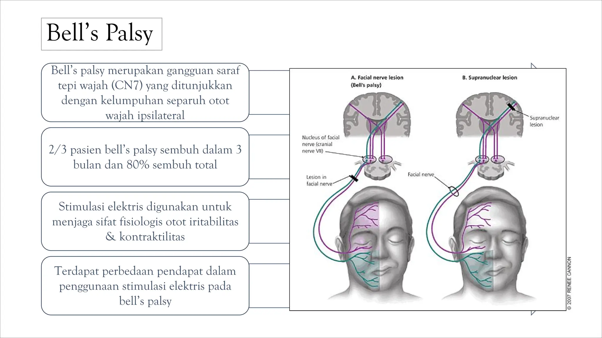 Materi Elektroterapi Fisioterapi Interrupted Galvanic (Exponential) Current | PPT