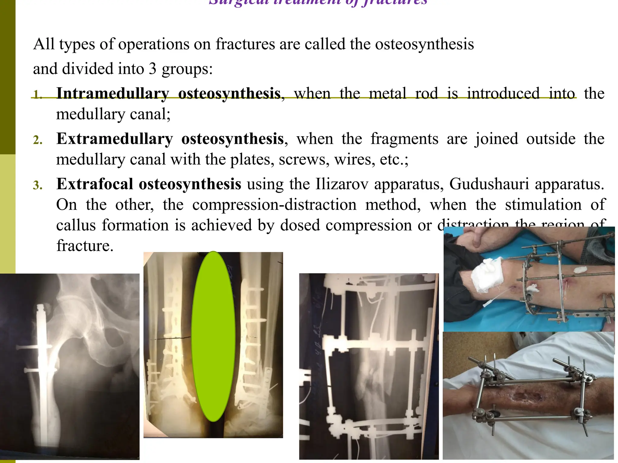 8. Fractures. Dislocations. Thermal injuries (lecture 8).pdf