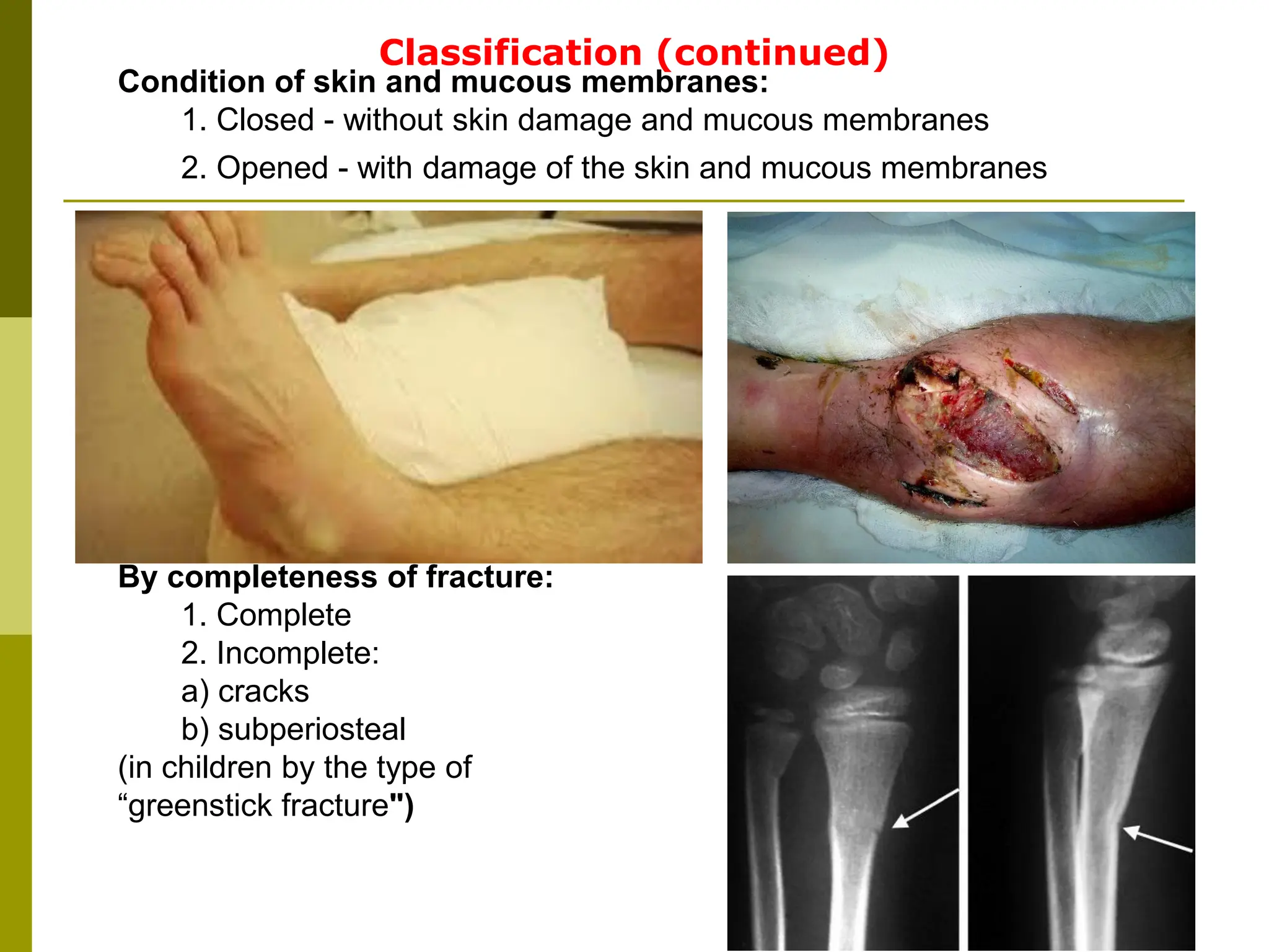 8. Fractures. Dislocations. Thermal injuries (lecture 8).pdf