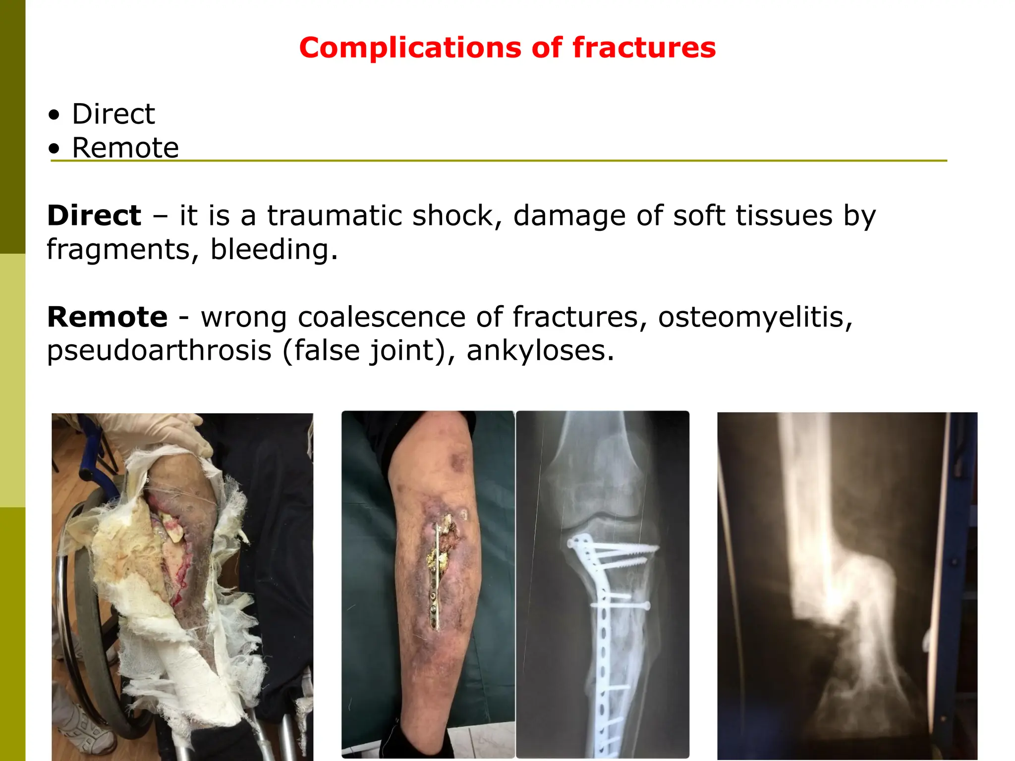 8. Fractures. Dislocations. Thermal injuries (lecture 8).pdf