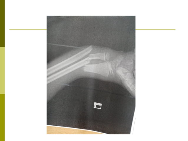 8. Fractures. Dislocations. Thermal injuries (lecture 8).pdf