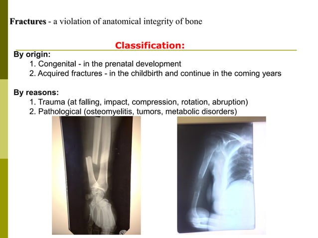 8. Fractures. Dislocations. Thermal injuries (lecture 8).pdf