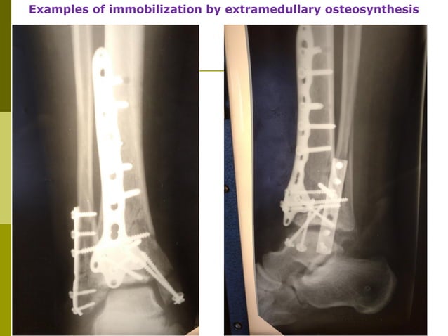 8. Fractures. Dislocations. Thermal injuries (lecture 8).pdf