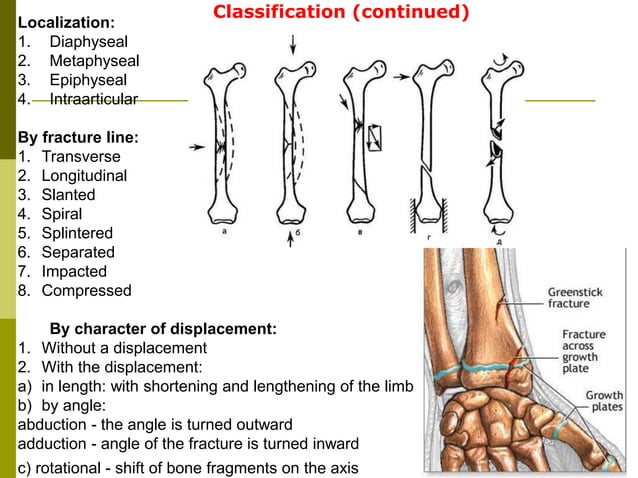 8. Fractures. Dislocations. Thermal injuries (lecture 8).pdf