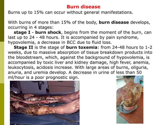 8. Fractures. Dislocations. Thermal injuries (lecture 8).pdf