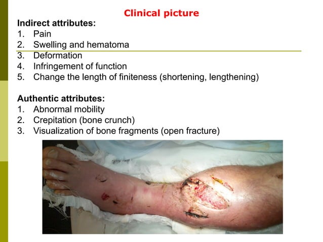 8. Fractures. Dislocations. Thermal injuries (lecture 8).pdf