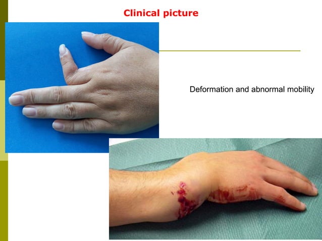 8. Fractures. Dislocations. Thermal injuries (lecture 8).pdf