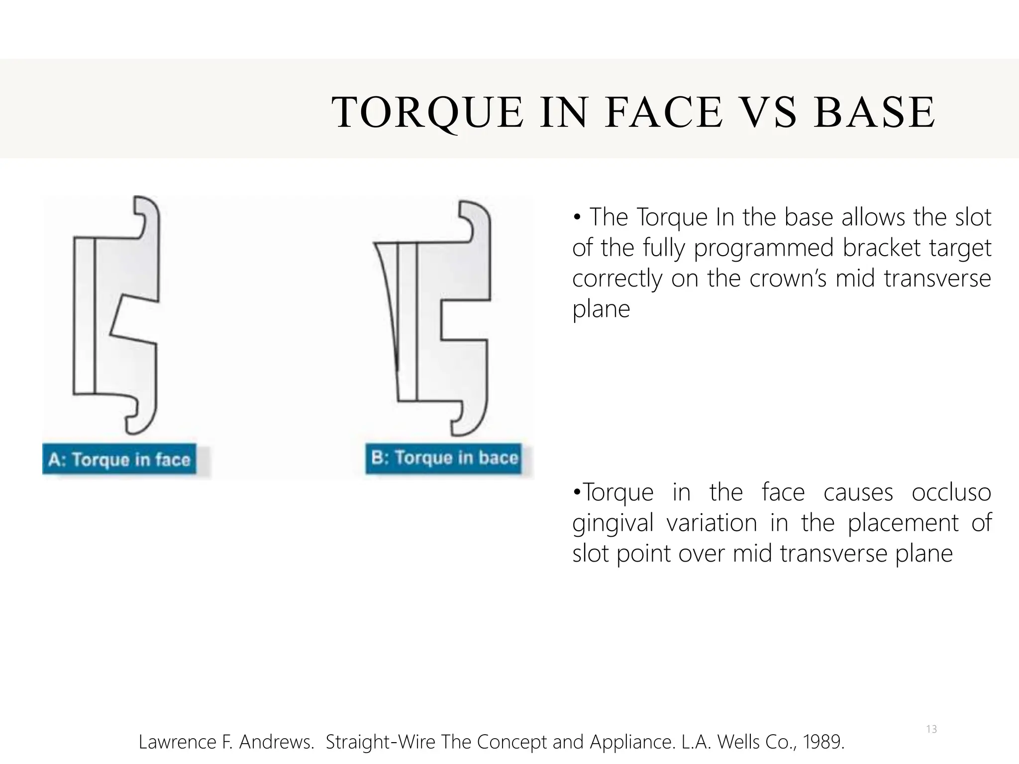 TORQUE IN ORTHODONTICS (short PPT) basic | PPTX